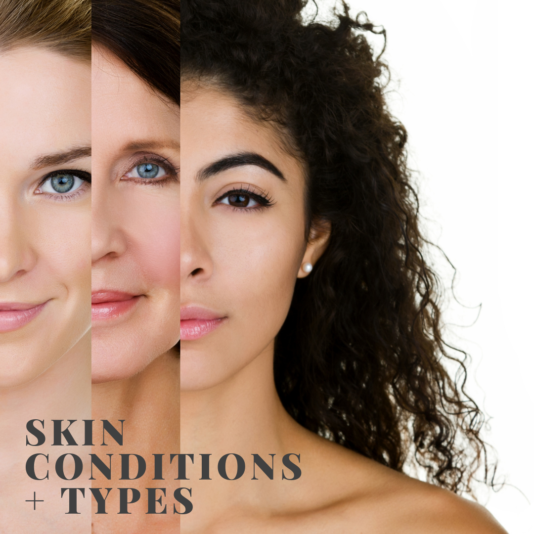Micro: Skin Conditions & Types